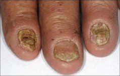 Nail Anatomy – Amytomically